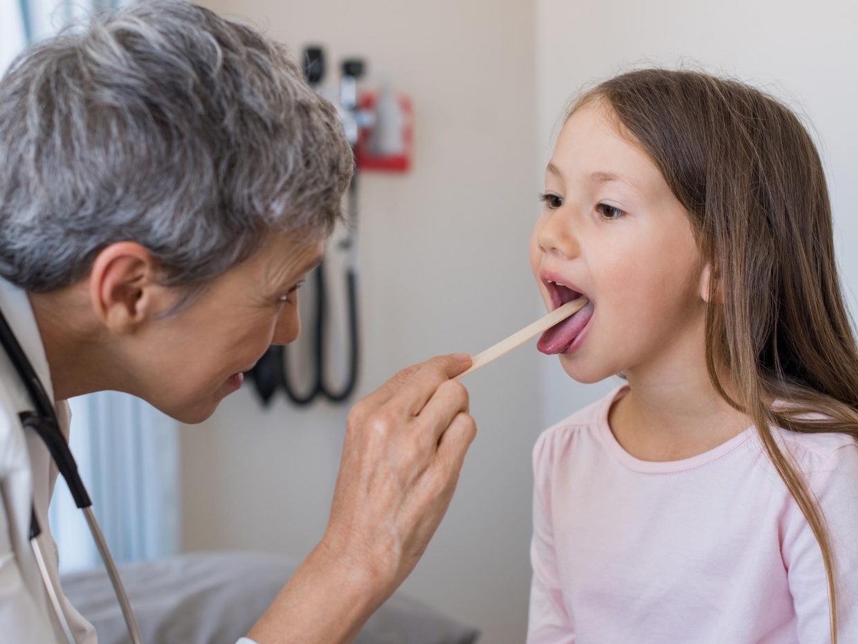 Afte nel bambino: cosa significano, cosa si può fare - Amico Pediatra