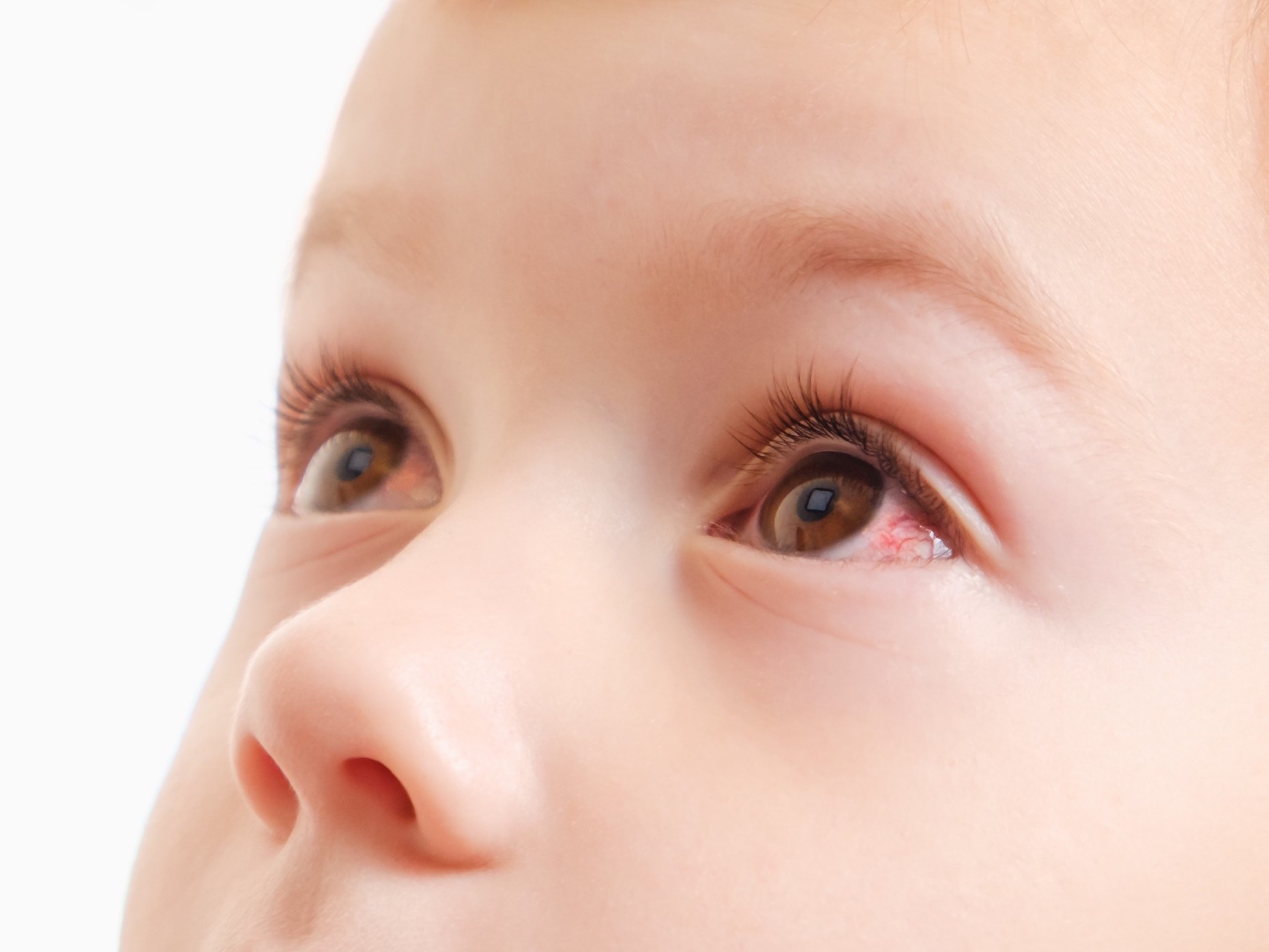 Occhi rossi: cosa possono significare, cosa fare - Amico Pediatra